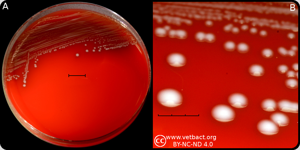 Enterococcus Faecalis On Blood Agar Colony A Rare Case Of Invasive