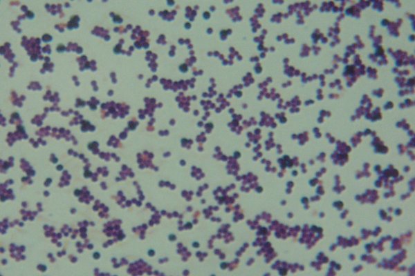 Staphylococcus aureus subsp. aureus.