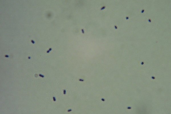 Rhodococcus hoagii