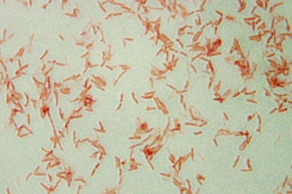 Aeromonas hydrophila subsp. hydrophila