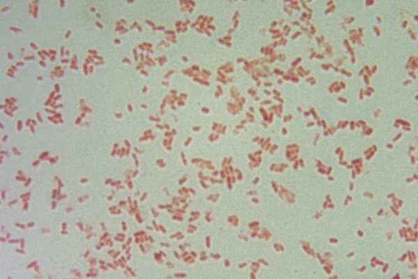 Yersinia enterocolitica subsp. enterocolitica