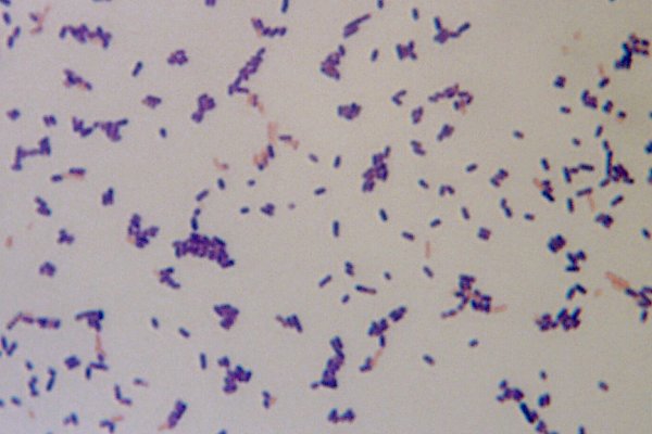 Listeria Monocytogenes Gram Stain As Seen In A Light