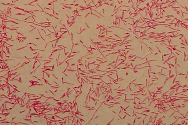 Flavobacterium psychrophilum