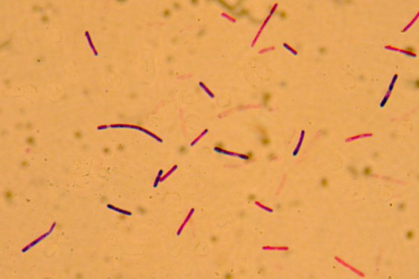 Clostridium Botulinum Gram Positive Stain