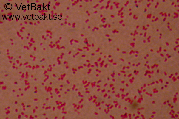 Bordetella pertussis