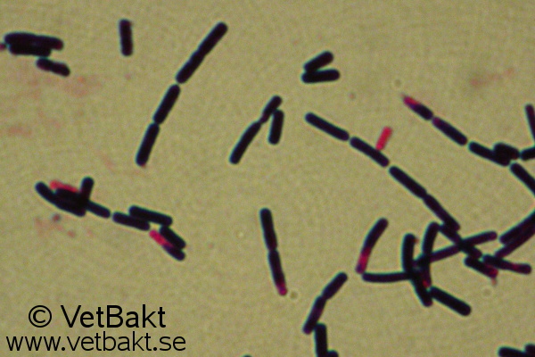 Bacillus Cereus Gram Stain