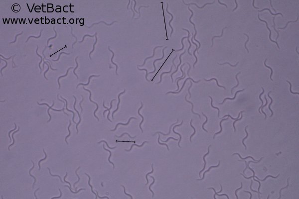 Brachyspira hyodysenteriae