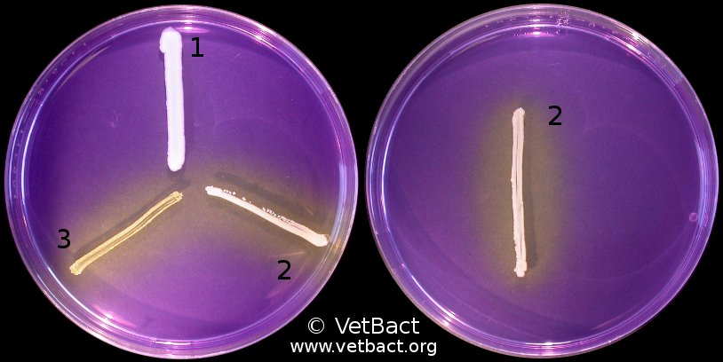 Staphylococcus aureus subsp. aureus