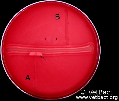 Streptococcus agalactiae