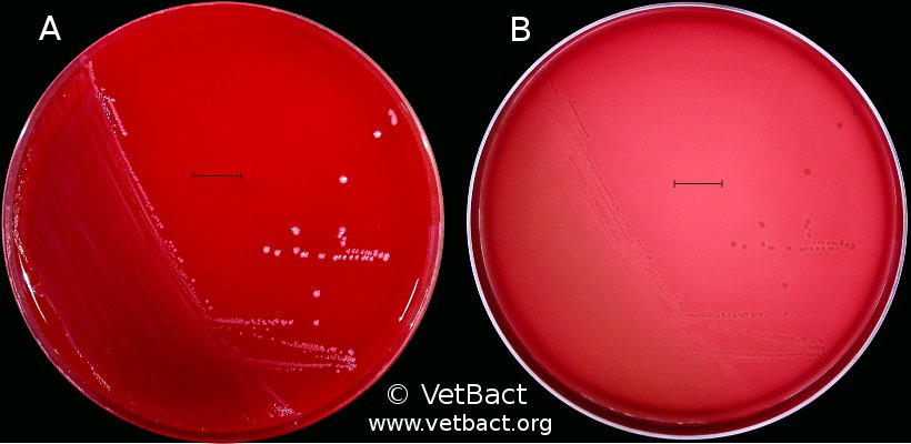 Streptococcus agalactiae