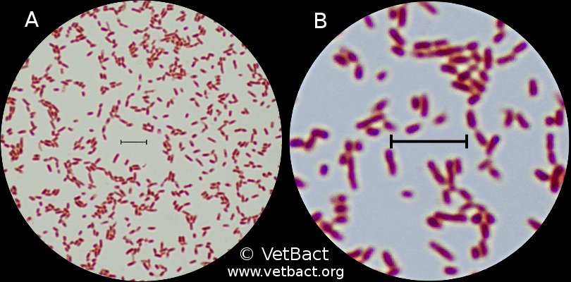 Klebsiella Pneumoniae Capsule Stain