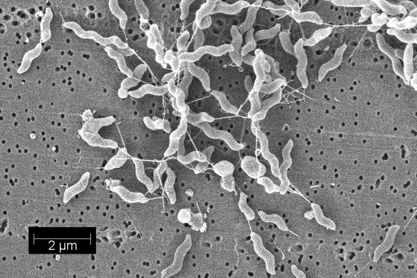 Campylobacter jejuni subsp. jejuni