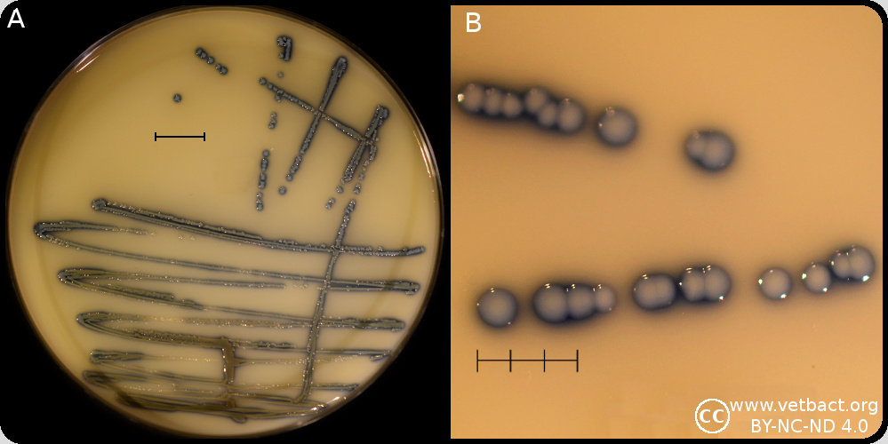 Staphylococcus aureus (MRSA)