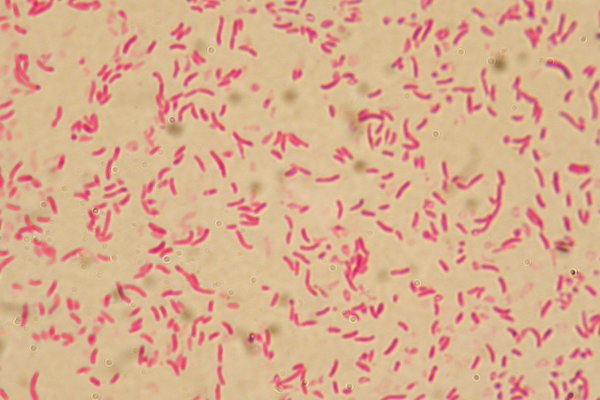 Vibrio Gram Stain Vibrio Detection